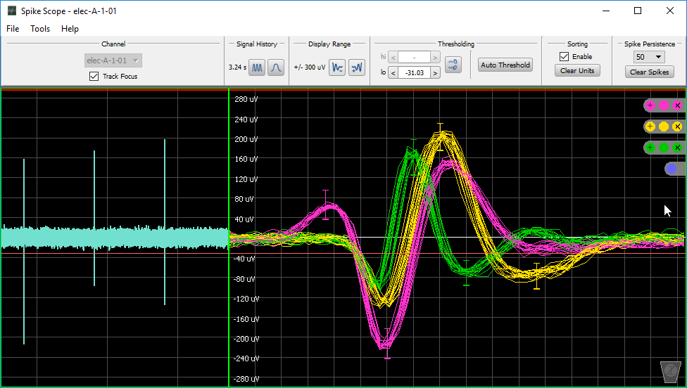 Software Downloads & Updates - Ripple Neuromed