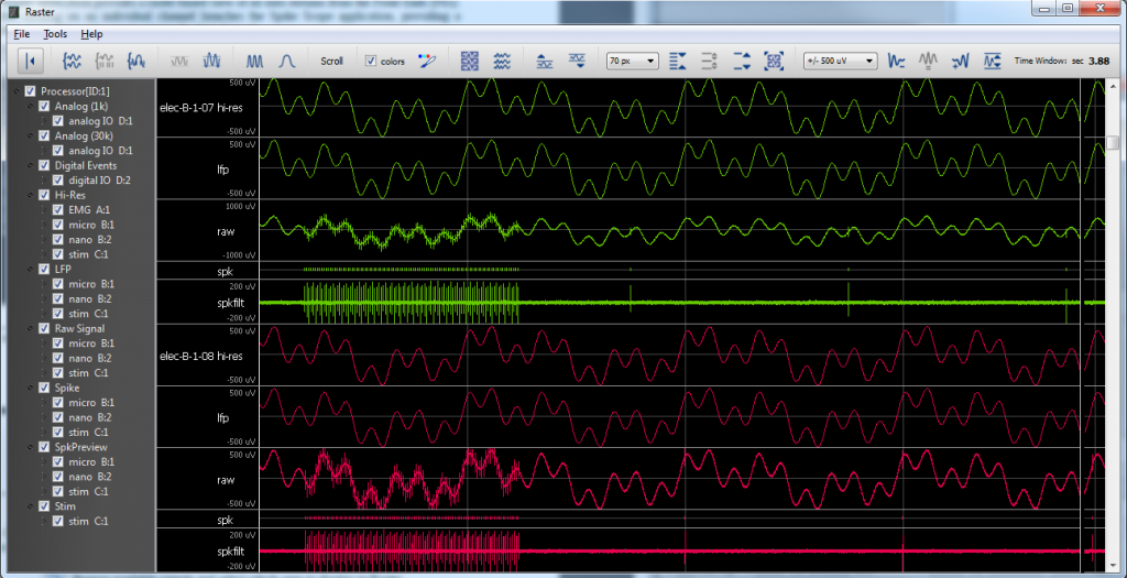 Trellis EEG & ERP Acquisition Software- Ripple Neuro