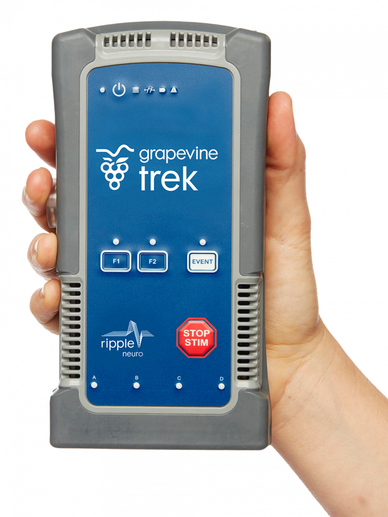 Custom Neuroscience Research Tools - Ripple Neuro